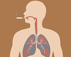 The Anatomy of Smoking